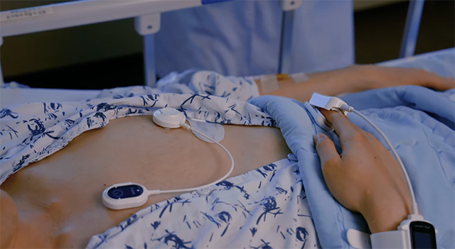 AI 체온 패치, 놓치기 쉬운 ‘야간 발열’ 조기 감지…씨어스테크놀로지 임상 성능 확인-디지틀조선일보(디조닷컴 dizzo.com)